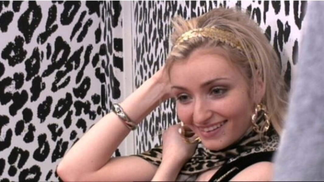 Télé-réalité : découvrez les candidats avant et après la chirurgie ...