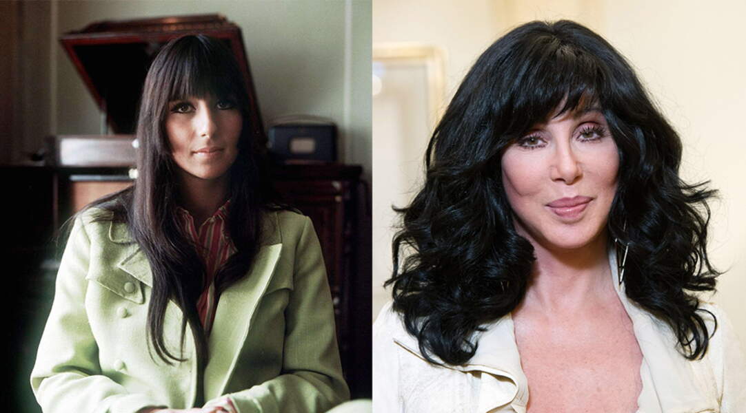 La chirurgie esthétique chez les people... pour le meilleur et pour le ...